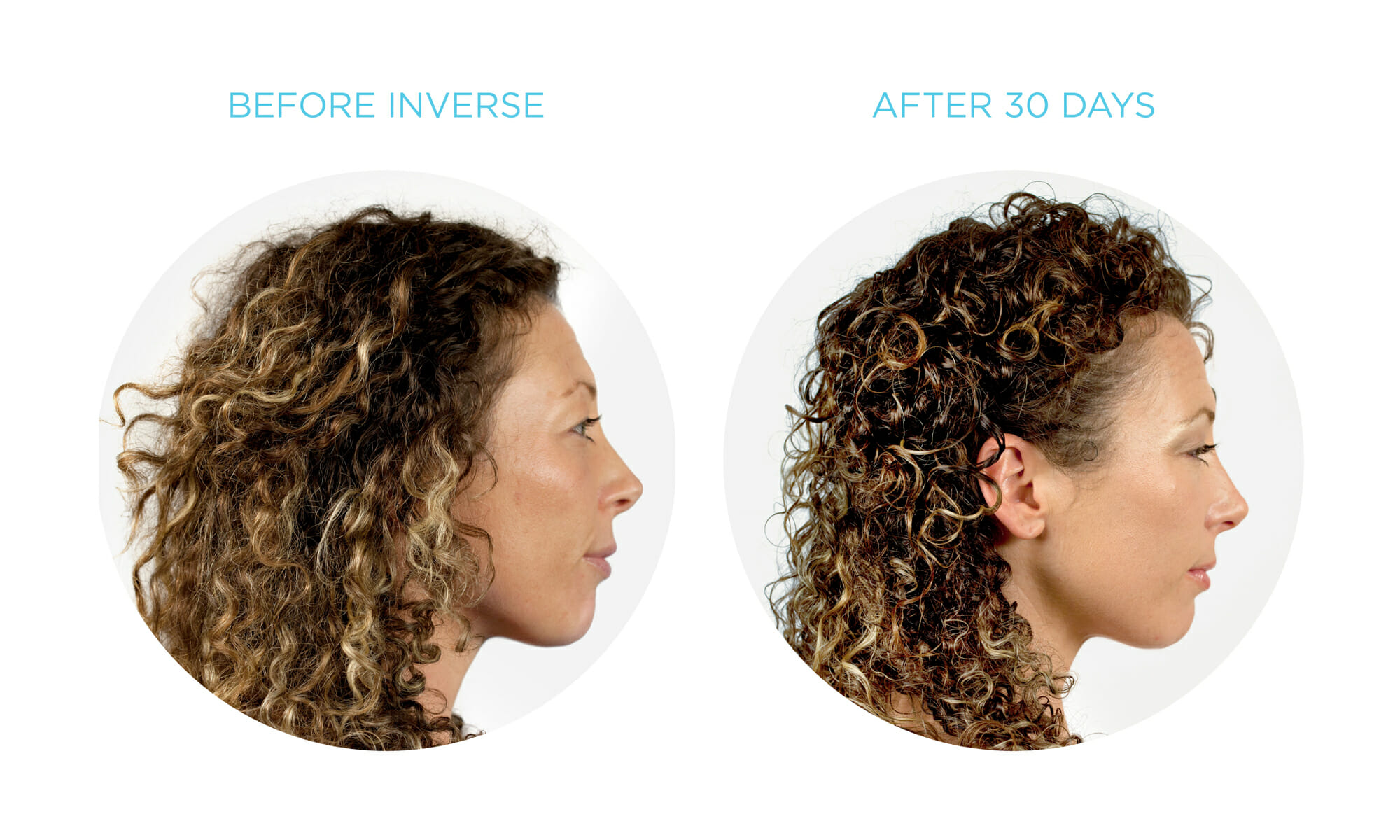 WIN, WIN, WIN! Gorgeous Hair with Inverse - MenoMe®